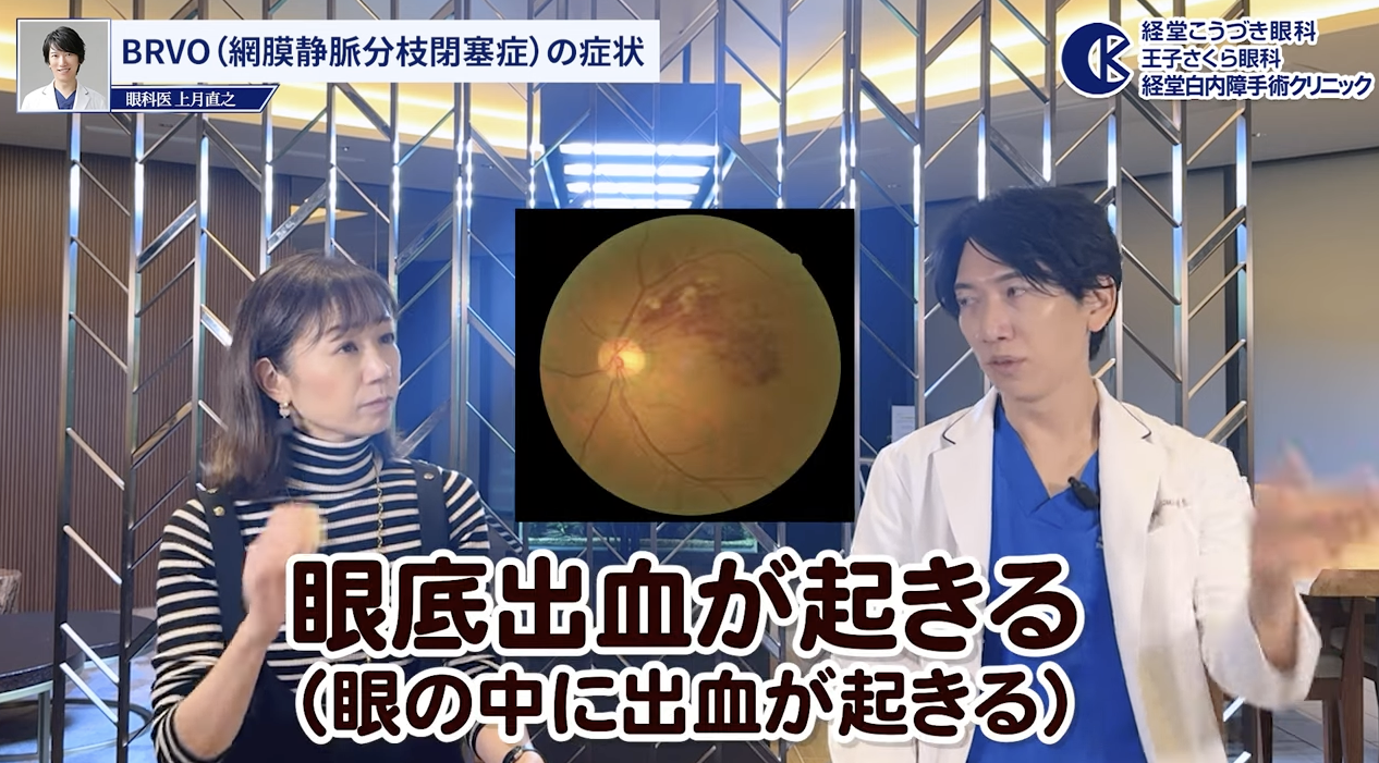【網膜静脈閉塞症徹底解説】BRVOとCRVOの違いから、抗VEGF注射・レーザー治療による視力回復策まで最新アプローチを詳解！ | コラム ...